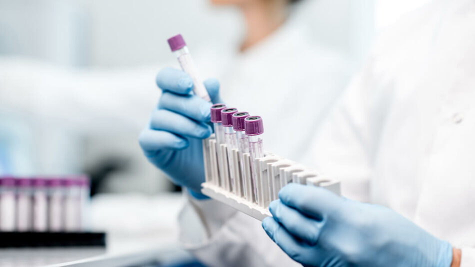 Laboratory Testing & Bloodwork | Clinique Médicale 360